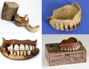 A Brief History of Dentures - Vernon Denture Clinic